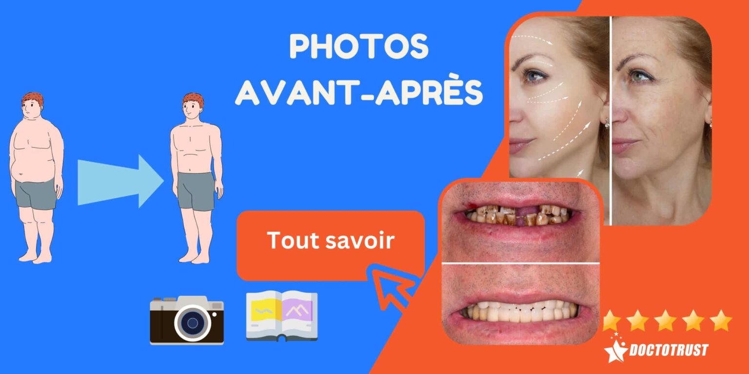 L'importance des photos avant et après en médecine